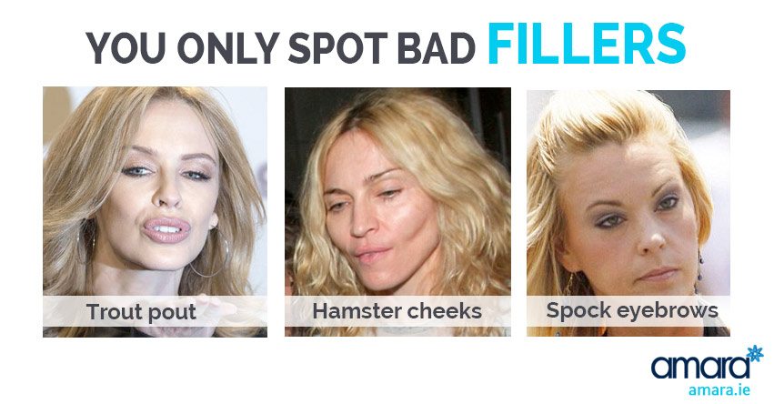 Why Are More People Choosing Fillers Over Botox?